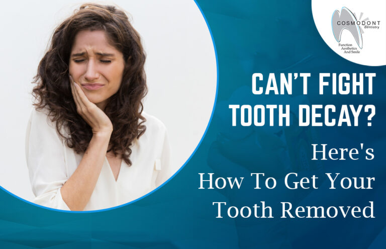 Can't Fight Tooth Decay? Here's How To Get Your Tooth Removed ...