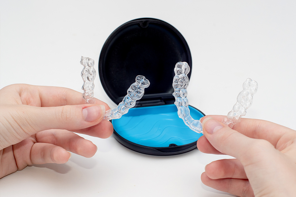 Invisible Braces in Toronto | Discreet Orthodontic Solutions