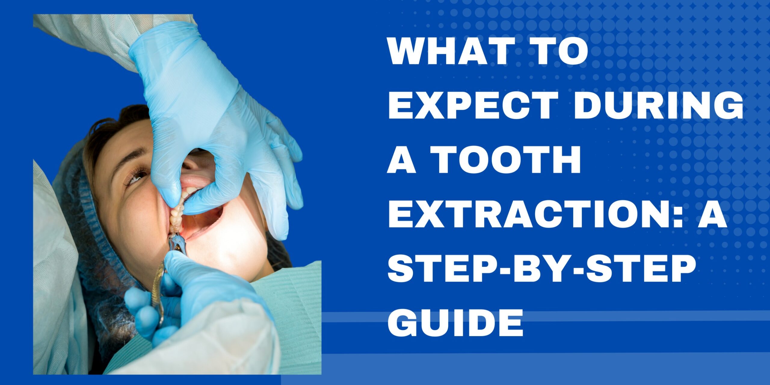 What to Expect During a Tooth Extraction: A Step-by-Step Guide ...